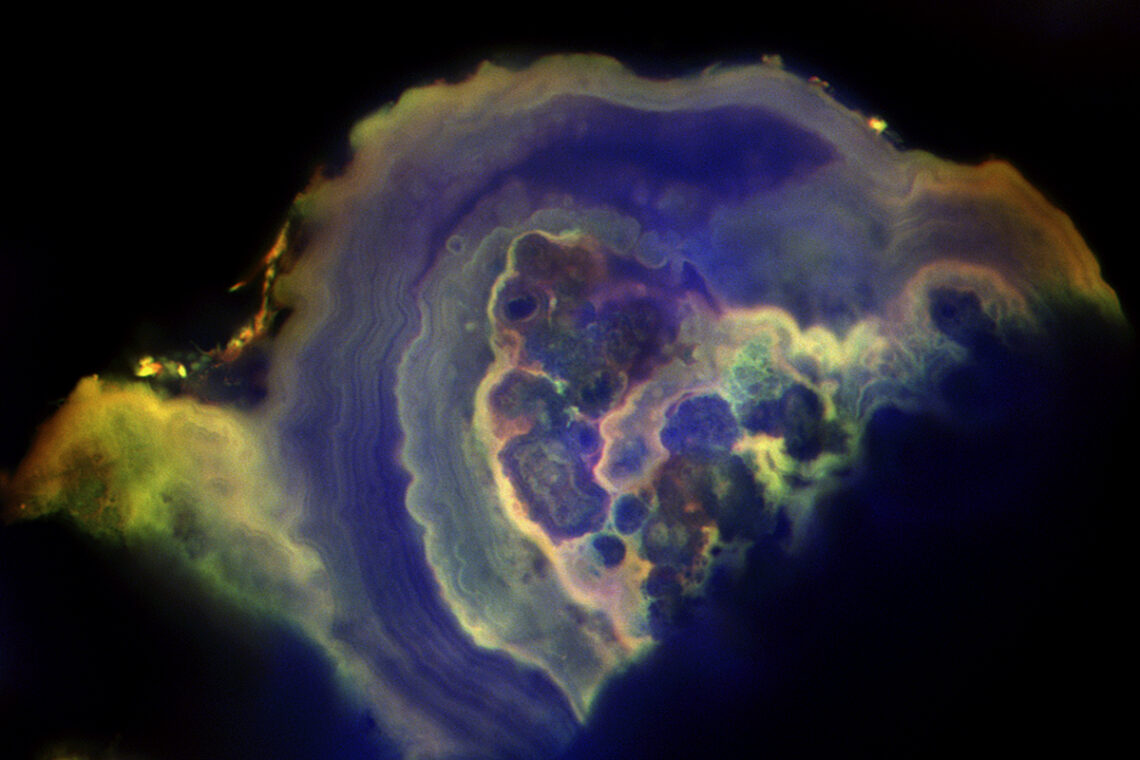 GeoBioMed tackles cancer | Department of Earth Science & Environmental ...